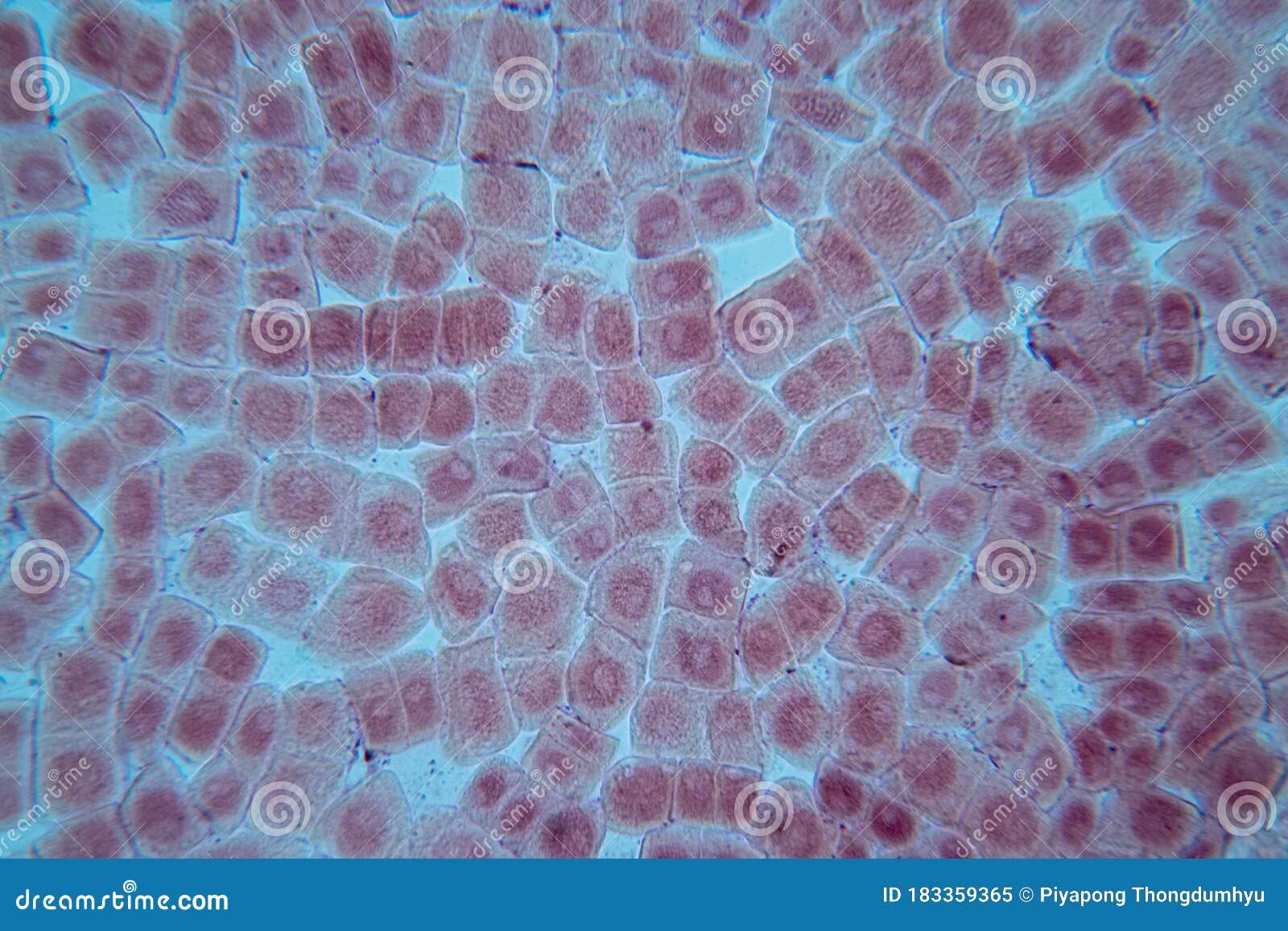 Mitosis Cell in the Root Tip of Onion Under a Microscope. Stock Image ...