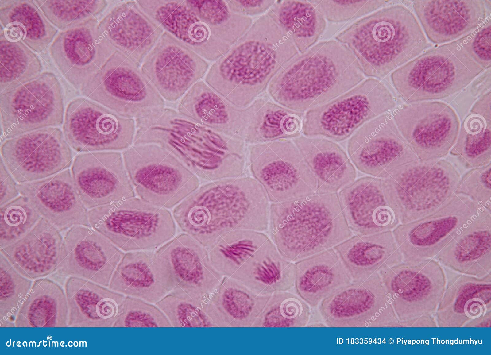 Mitosis Cell in the Root Tip of Onion Under a Microscope. Stock Photo ...