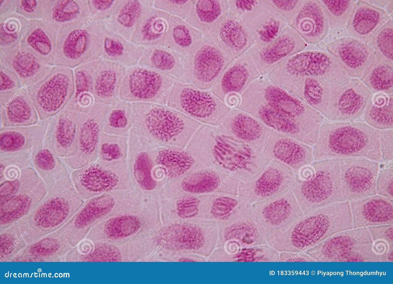 Mitosis Cell in the Root Tip of Onion Under a Microscope. Stock Image ...