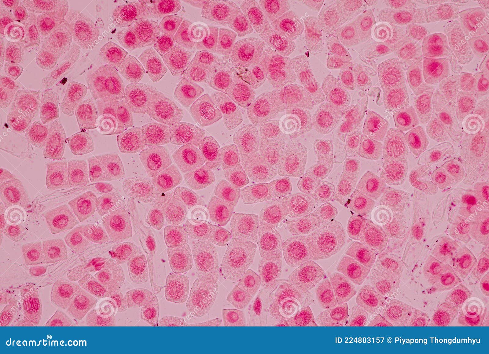 Mitosis Cell in the Root Tip of Onion Under a Microscope. Stock Image ...