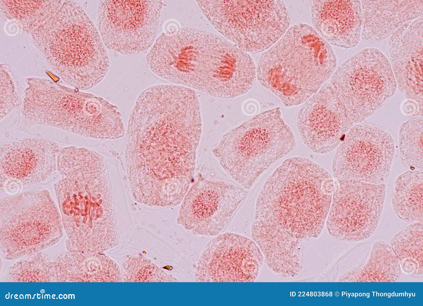 Mitosis Cell in the Root Tip of Onion Under a Microscope. Stock Photo ...