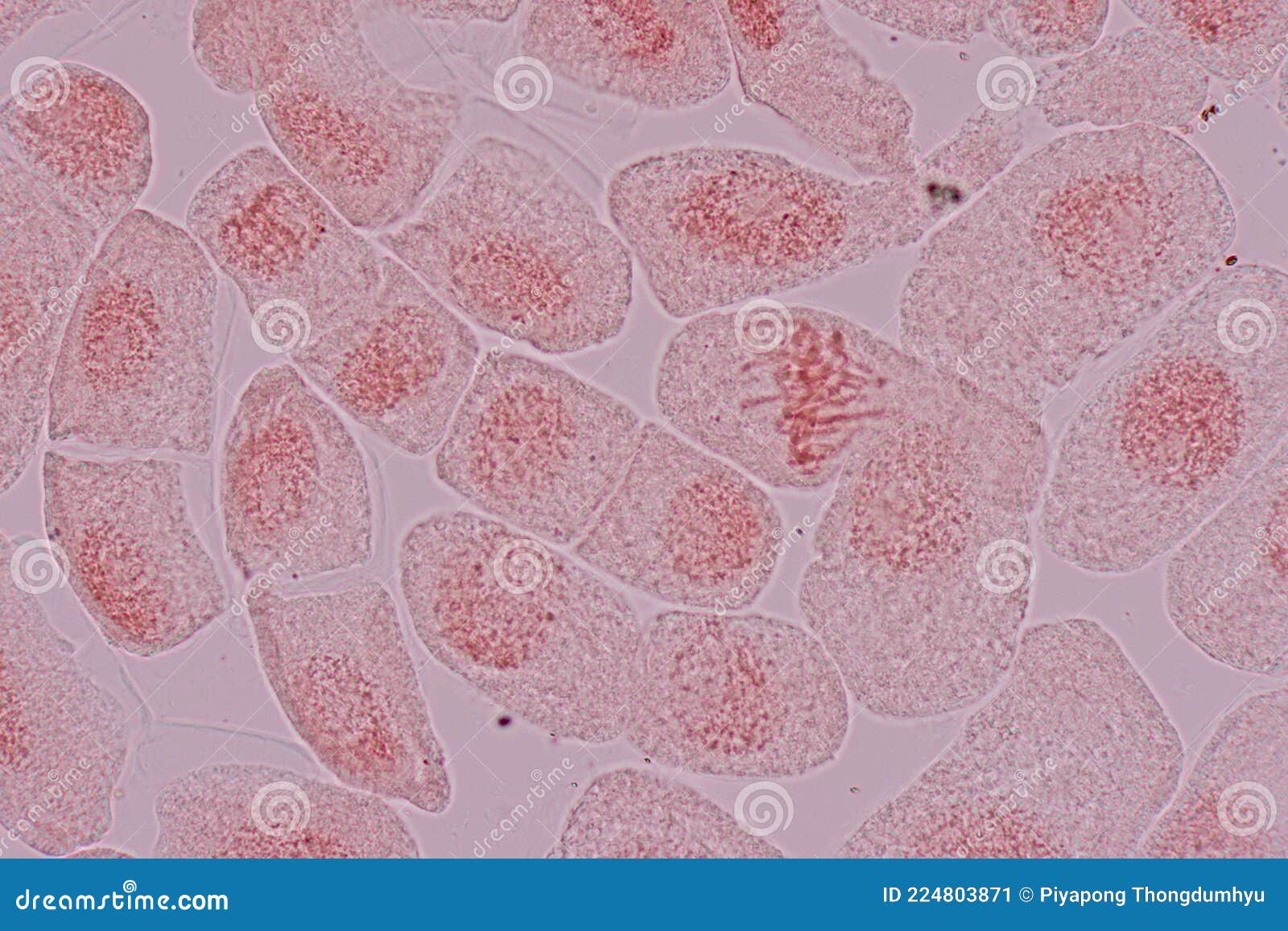 Mitosis Cell in the Root Tip of Onion Under a Microscope. Stock Image ...