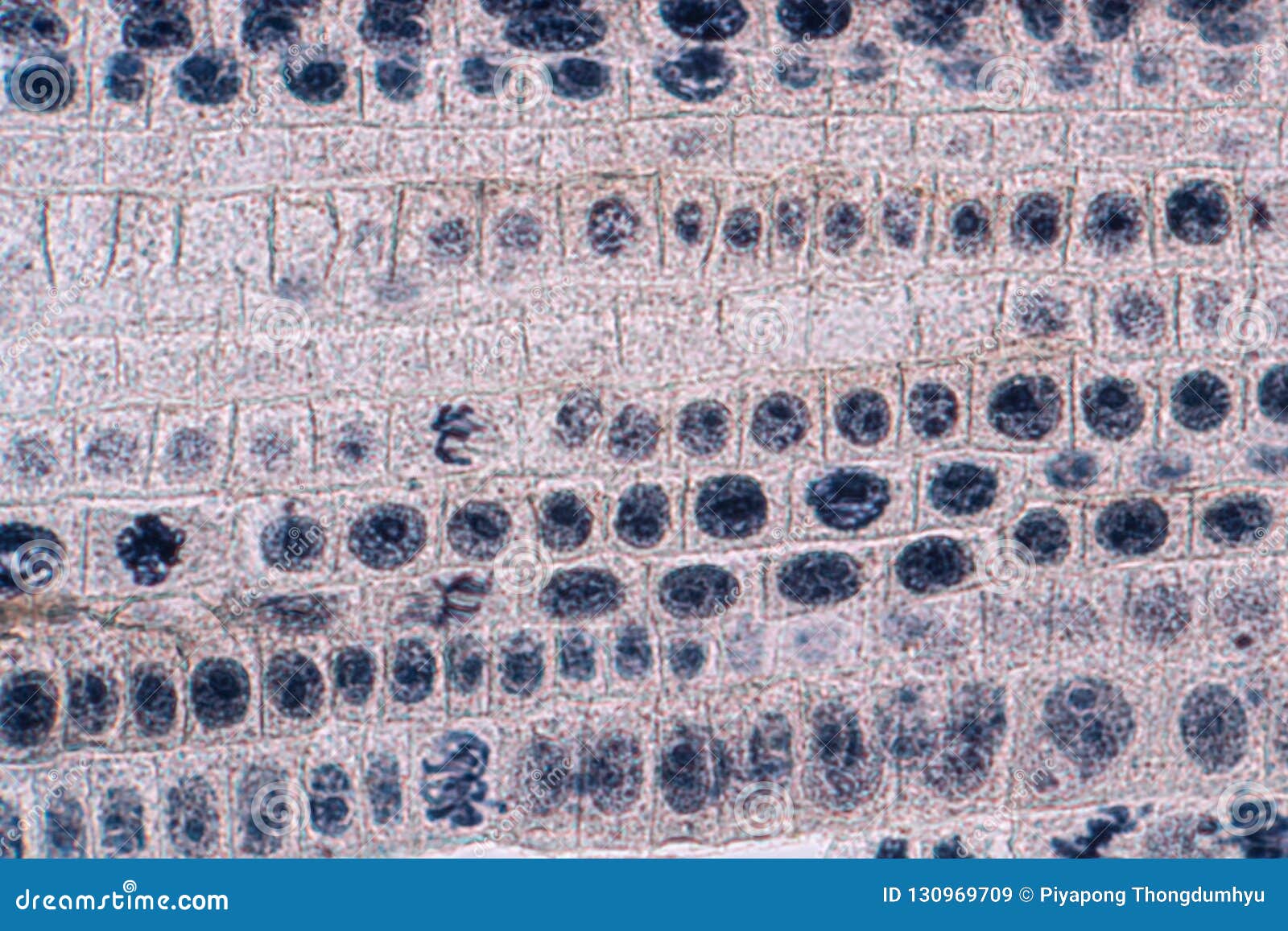 Root Tip of Onion and Mitosis Cell in the Root Tip of Onion Under a ...