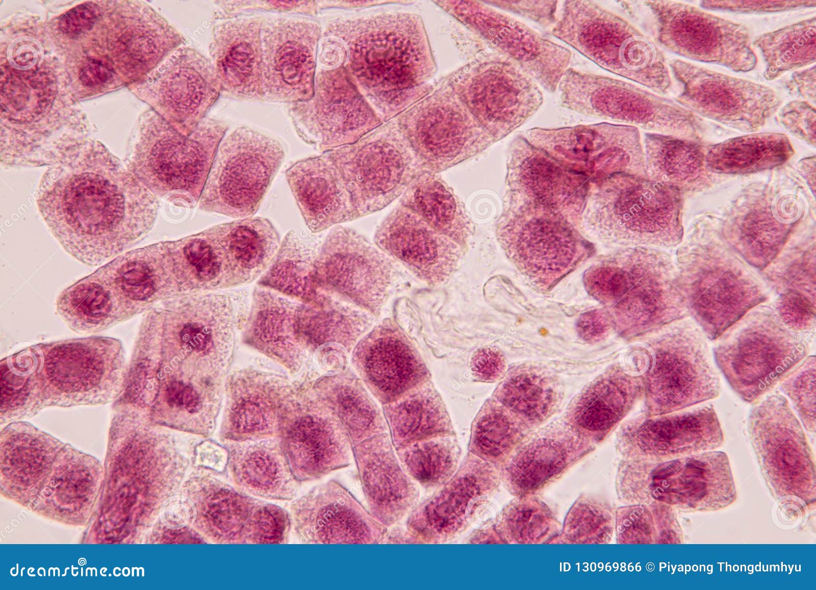Root Tip of Onion and Mitosis Cell in the Root Tip of Onion Under a ...