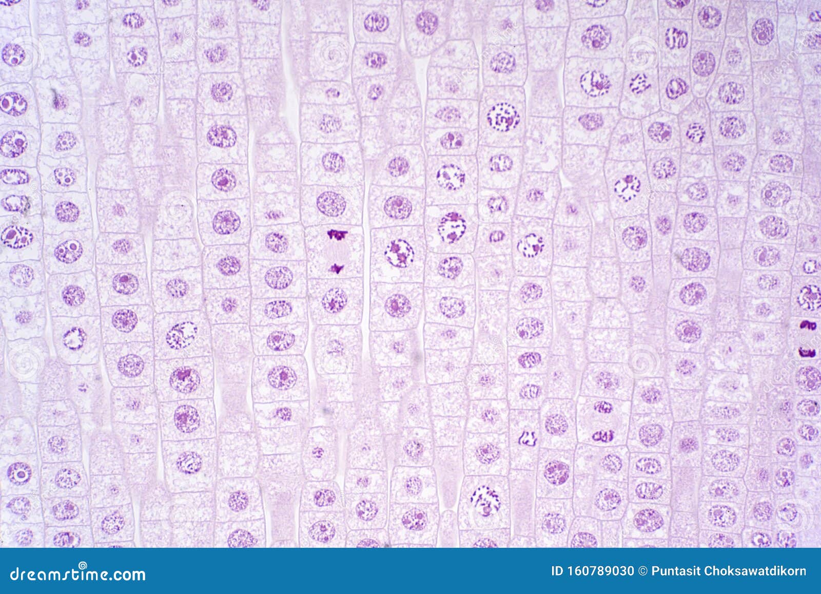 Root Tip of Onion Show Mitosis Cell in the Root Tip Under Microscope ...