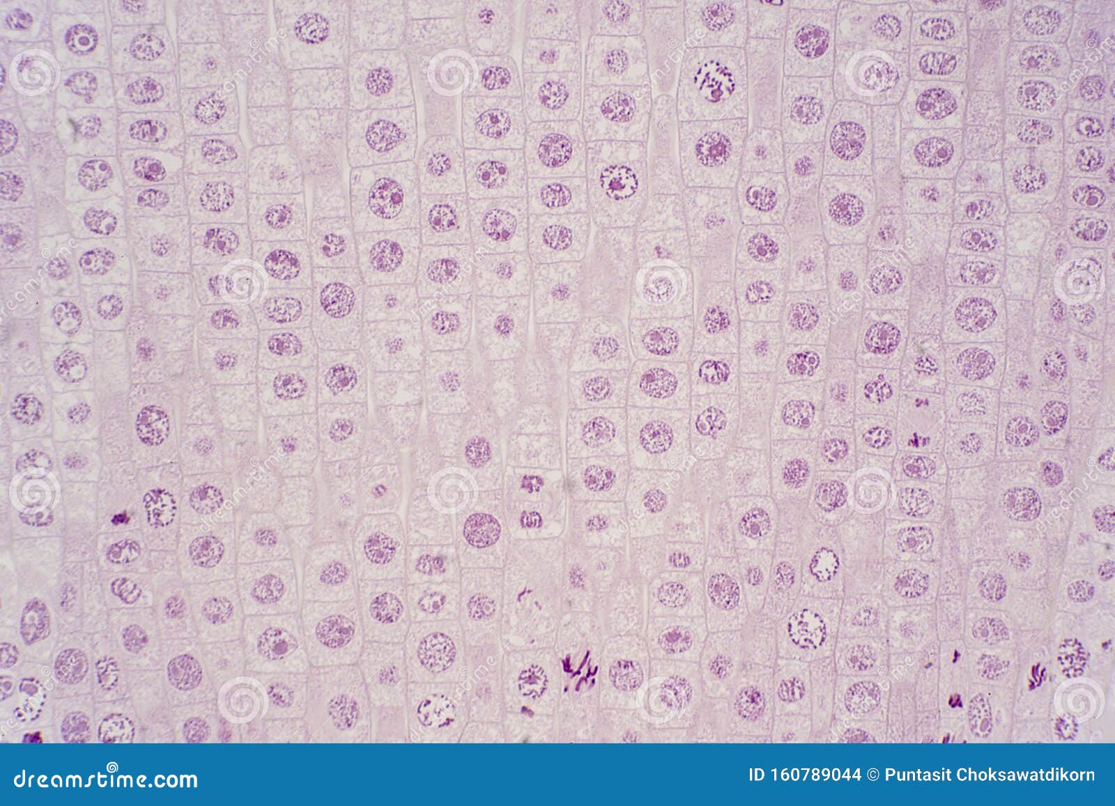 Root Tip of Onion Show Mitosis Cell in the Root Tip Under Microscope ...