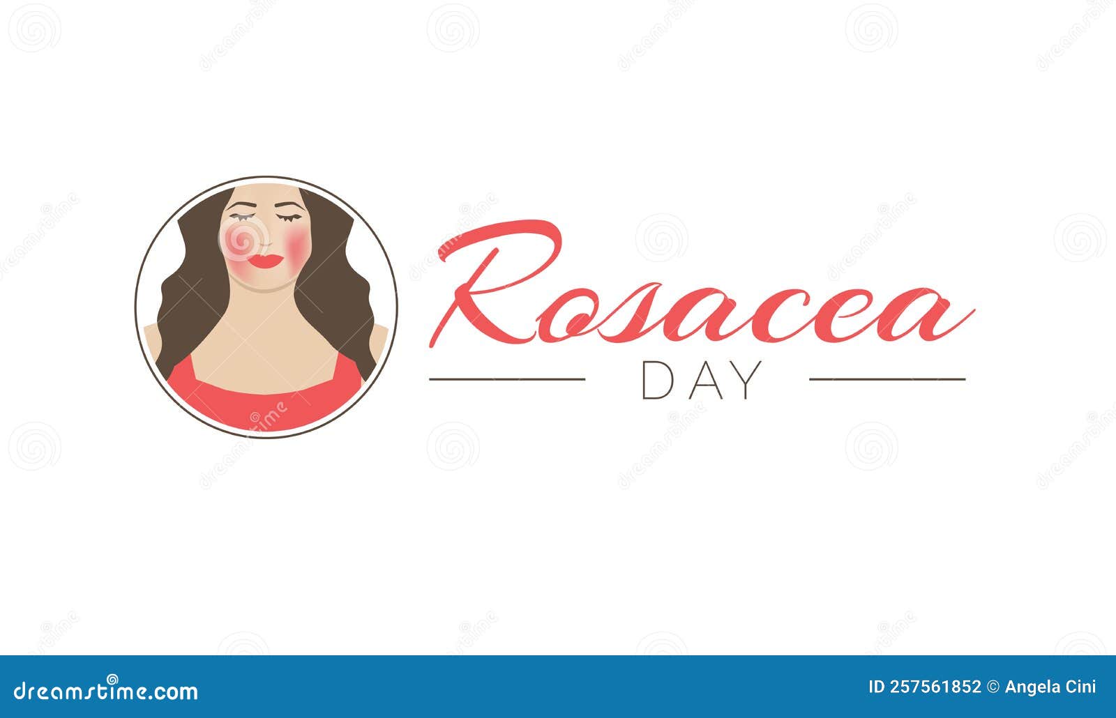 Rosacea. Rosacea Awareness Month. Infographics. Vector Illustration On ...