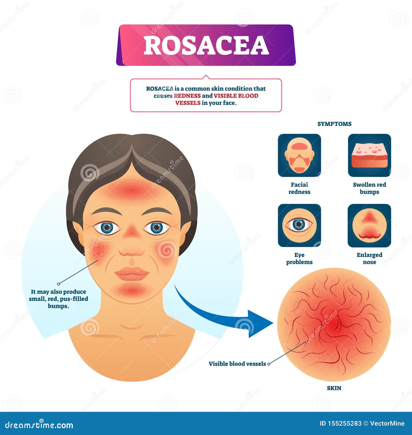 Visible Problem Stock Illustrations – 239 Visible Problem Stock ...