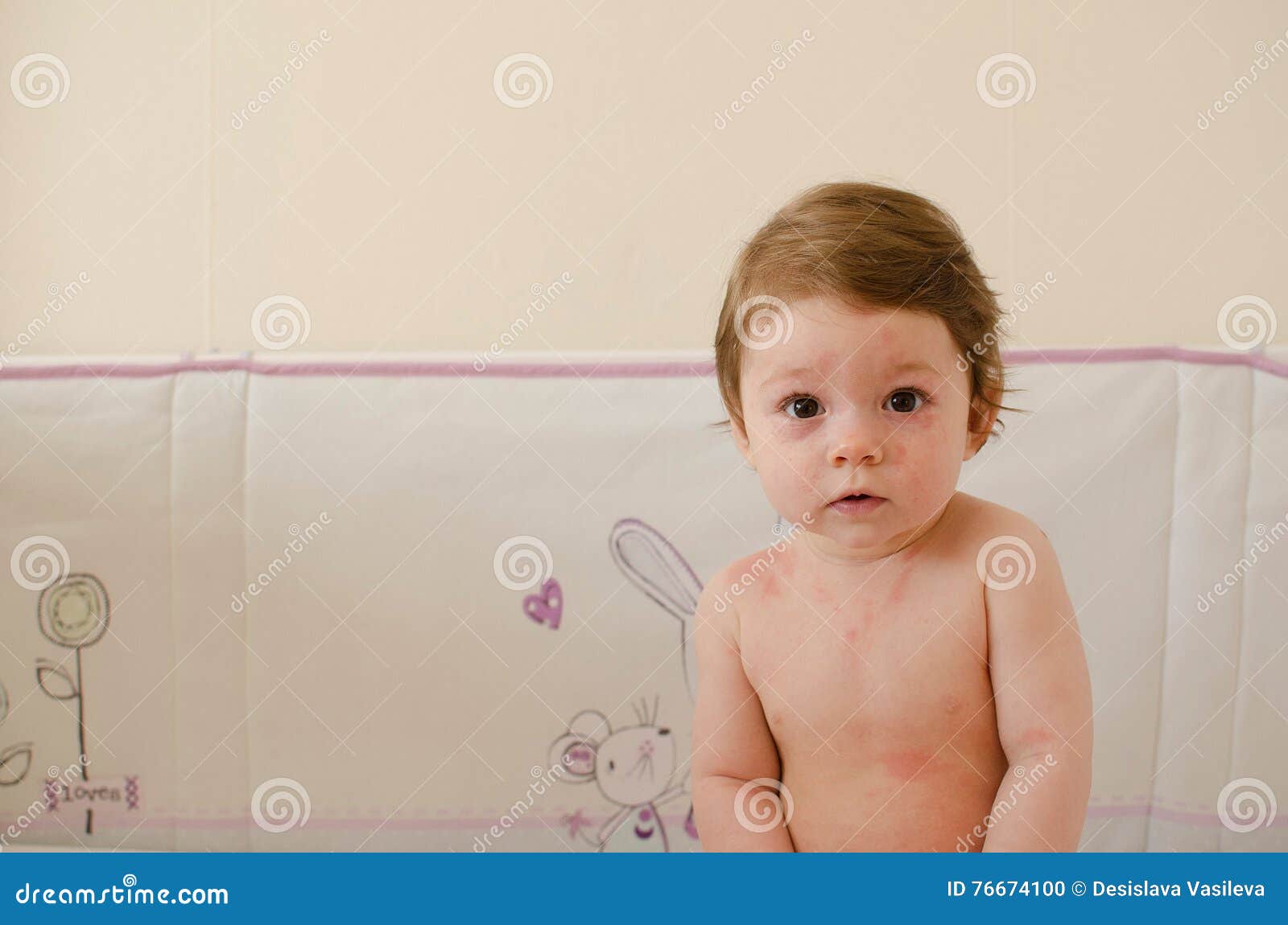 Roseola infantum arkivfoto. Bild av prick, bebis, punkt - 76674100