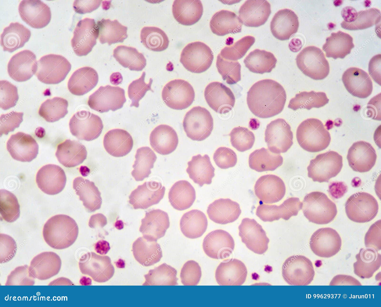 Rote Blutzellen stockbild. Bild von prüfung, blut, mikroskop - 99629377