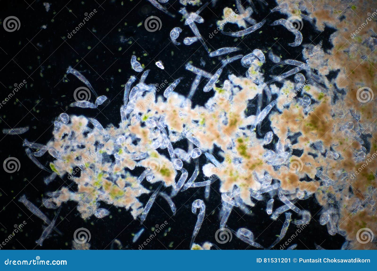 The rotifer stock image. Image of light, contrast, larva - 81531201