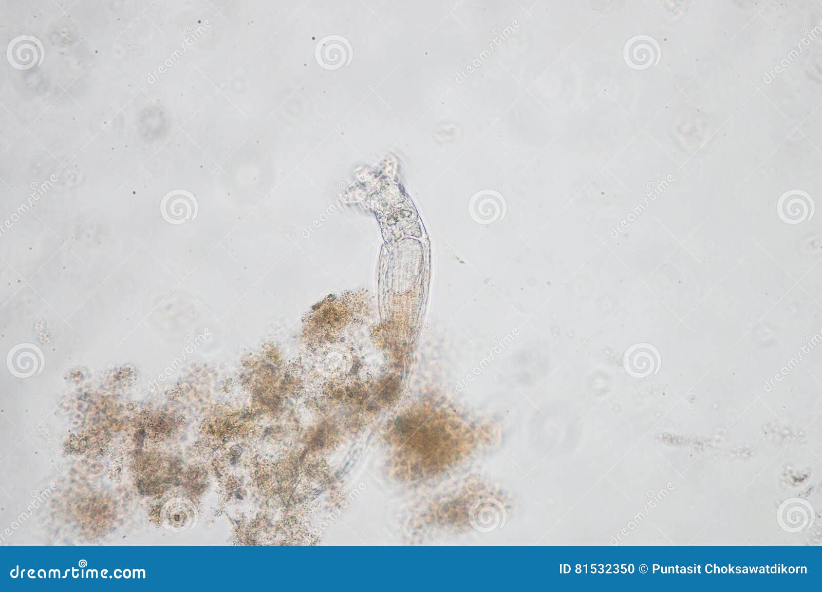The Rotifer Rotifera, Commonly Called Wheel Animals Under The ...