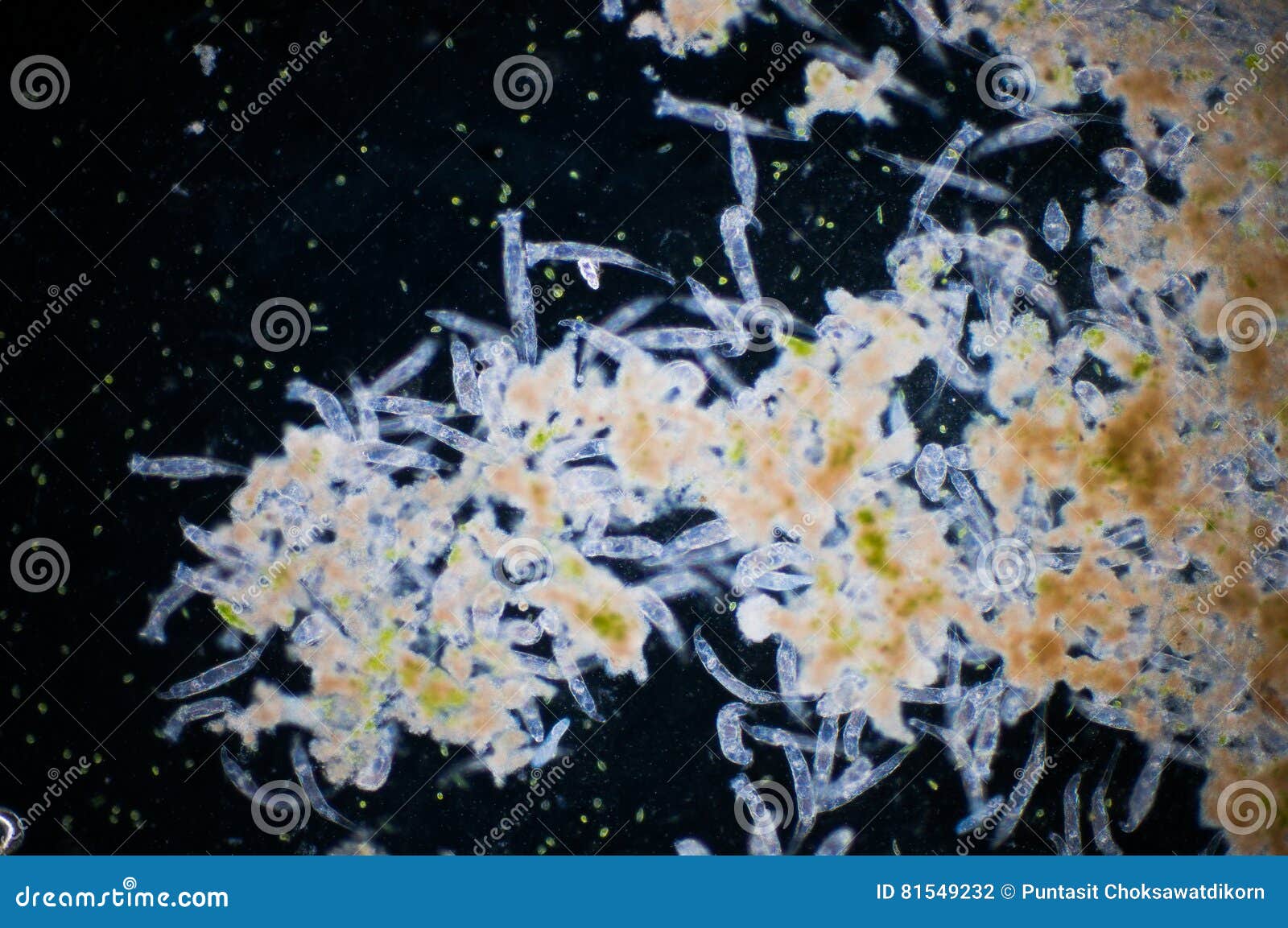 The rotifer stock photo. Image of macro, closeup, cell - 81549232