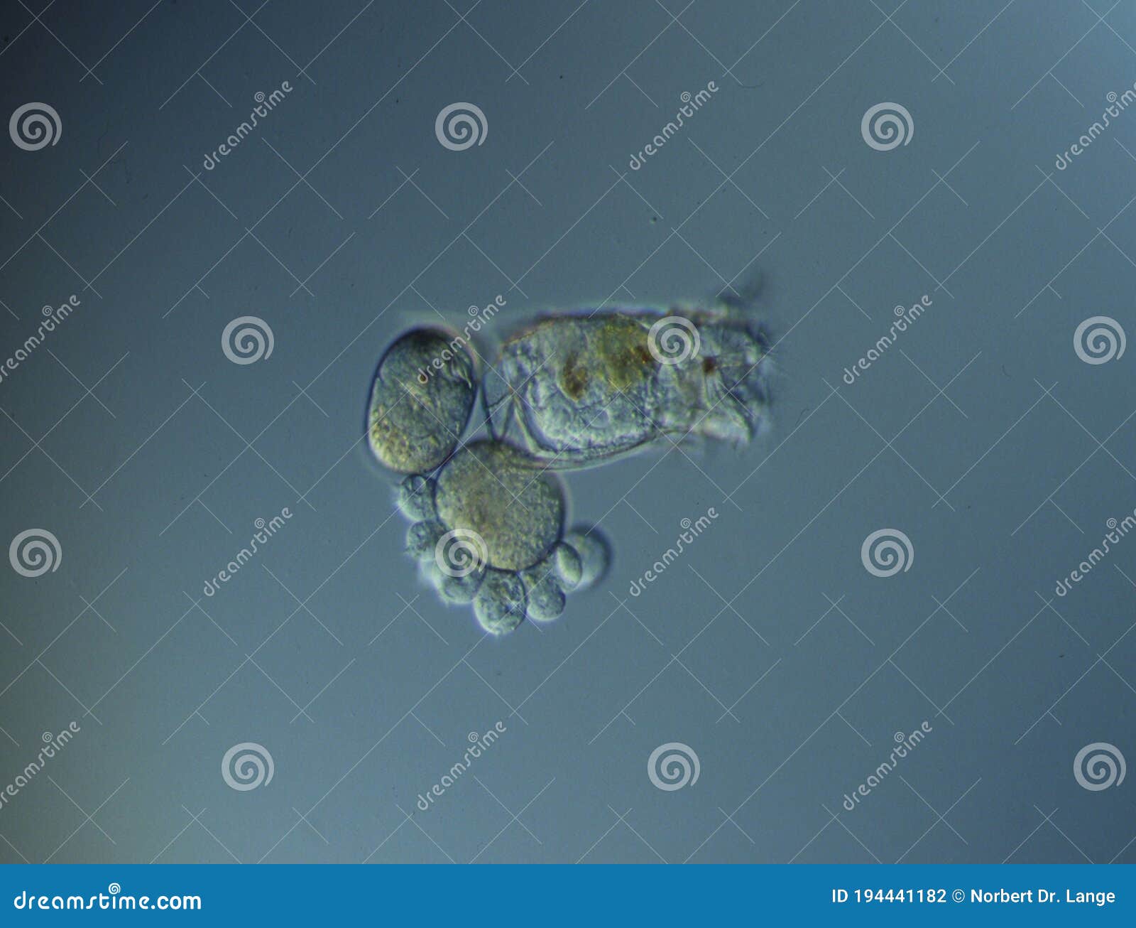 Rotifers swim in the water stock photo. Image of microscopy - 194441182