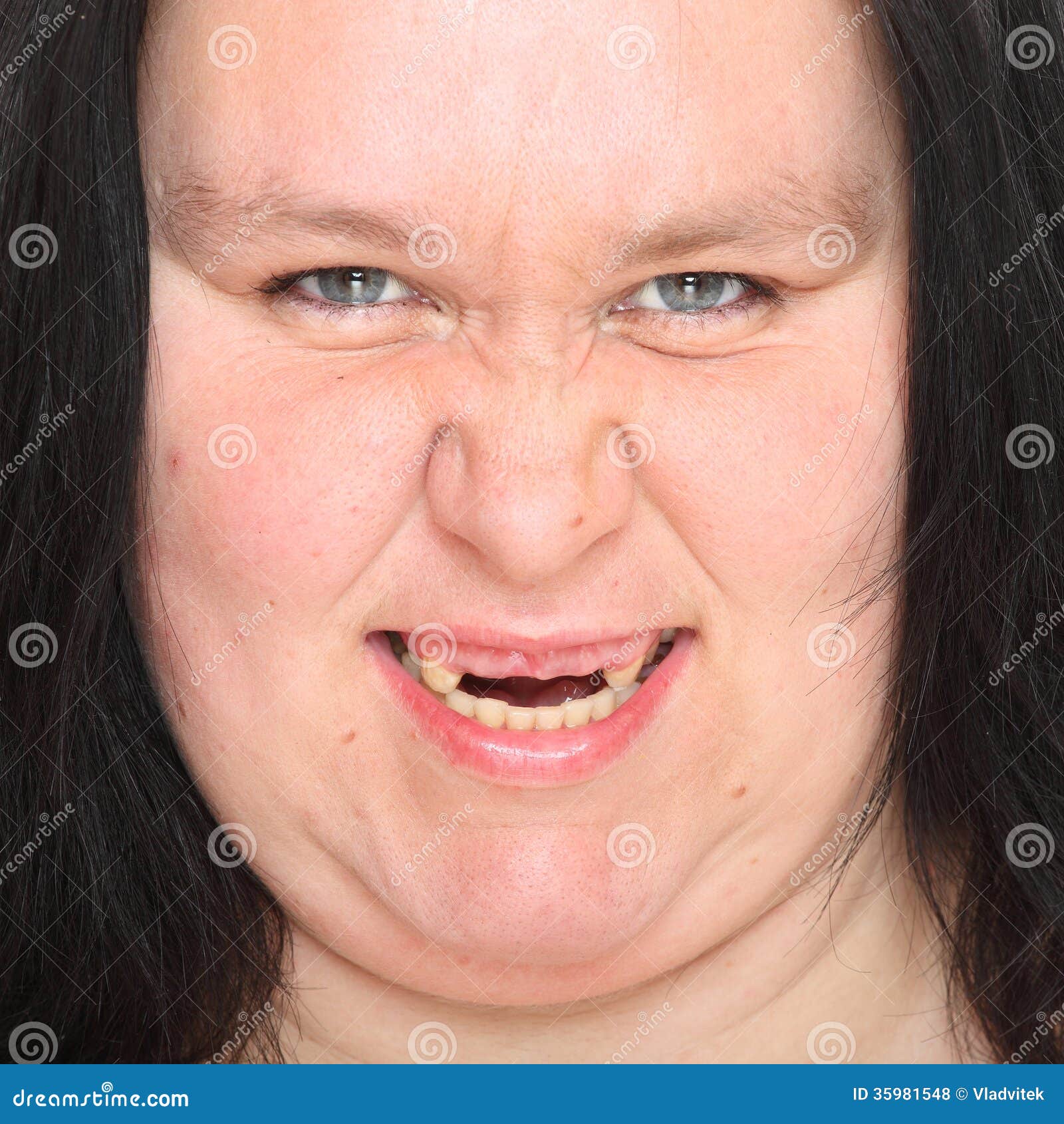 Rotte tanden. stock foto. Image of monster, recht, ontbrekende - 35981548