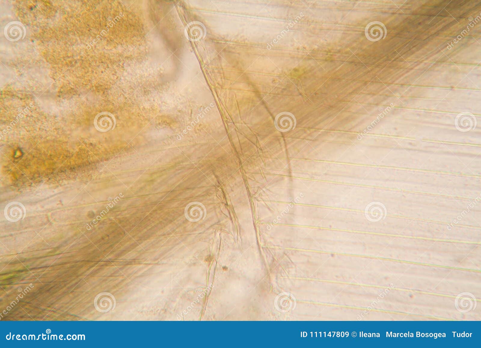 Rotten Leaves at the Microscope Stock Image - Image of organic ...