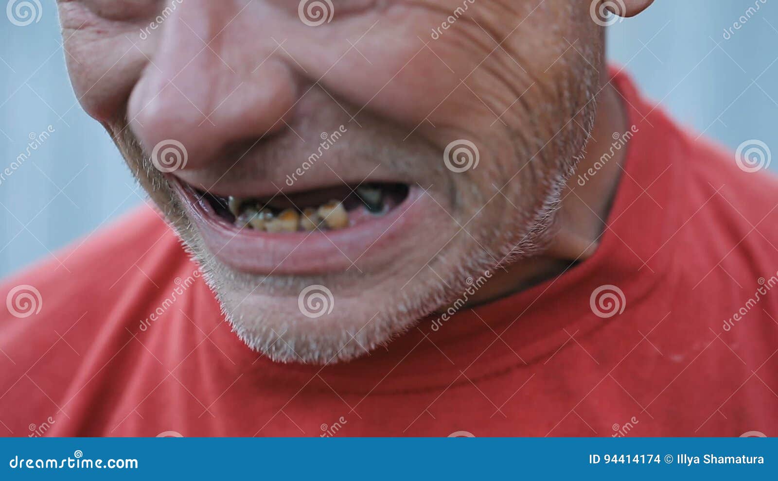 Ugly People Rotten Teeth