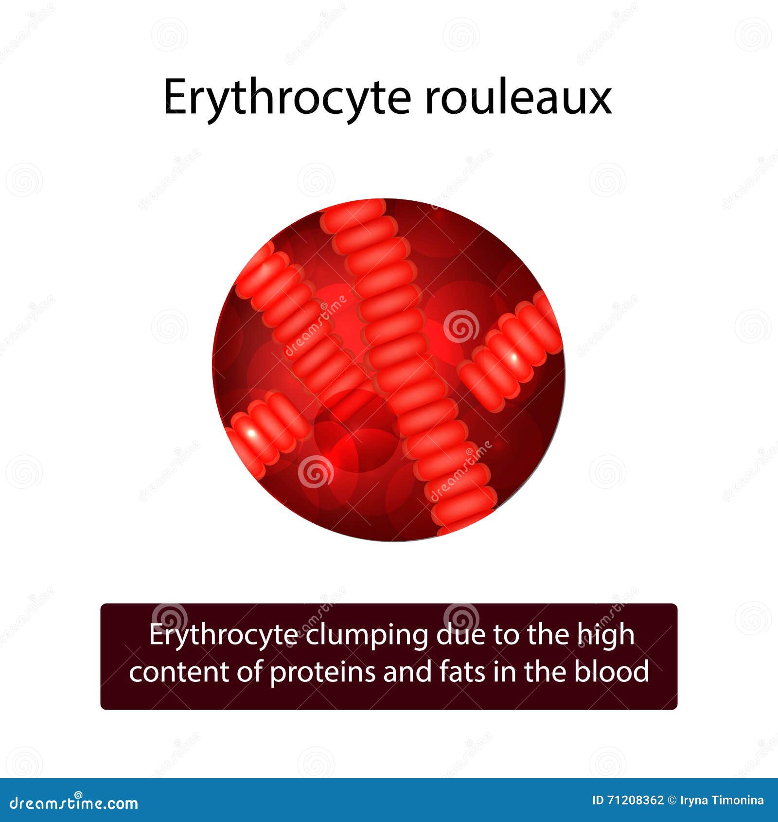 Rouleaux Des Globules Rouges Illustration de Vecteur - Illustration du ...