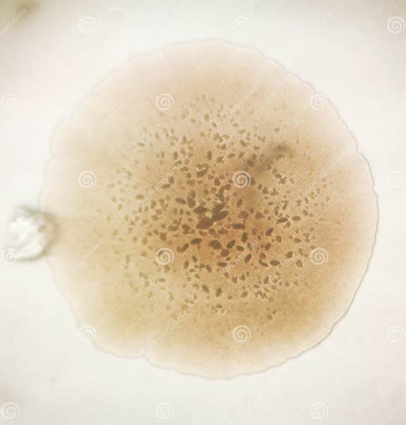 A Round Shaped Bacterial Colony Under the Optical Microscope Stock ...