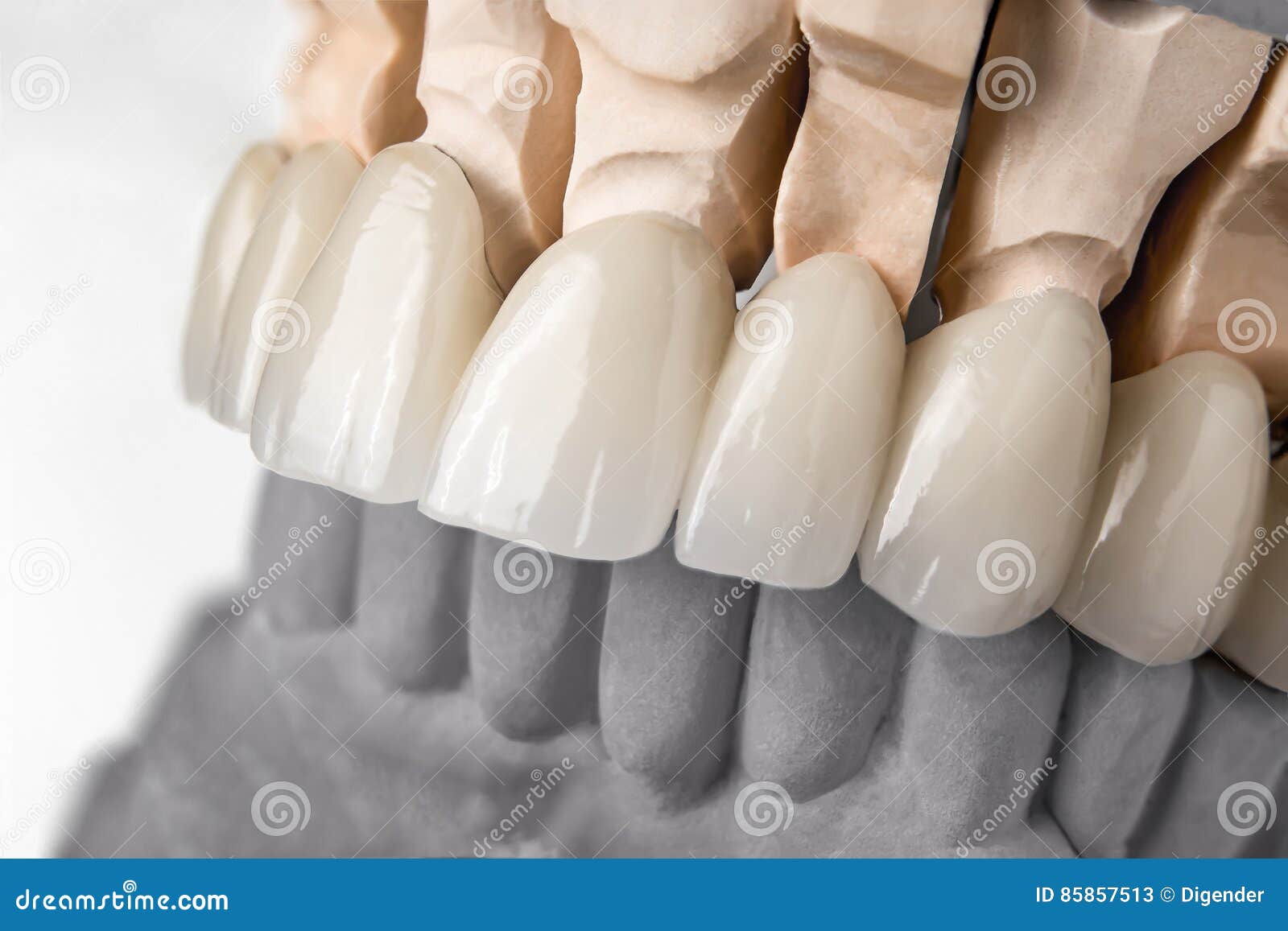 Row of teeth prosthesis stock image. Image of false, mold - 85857513