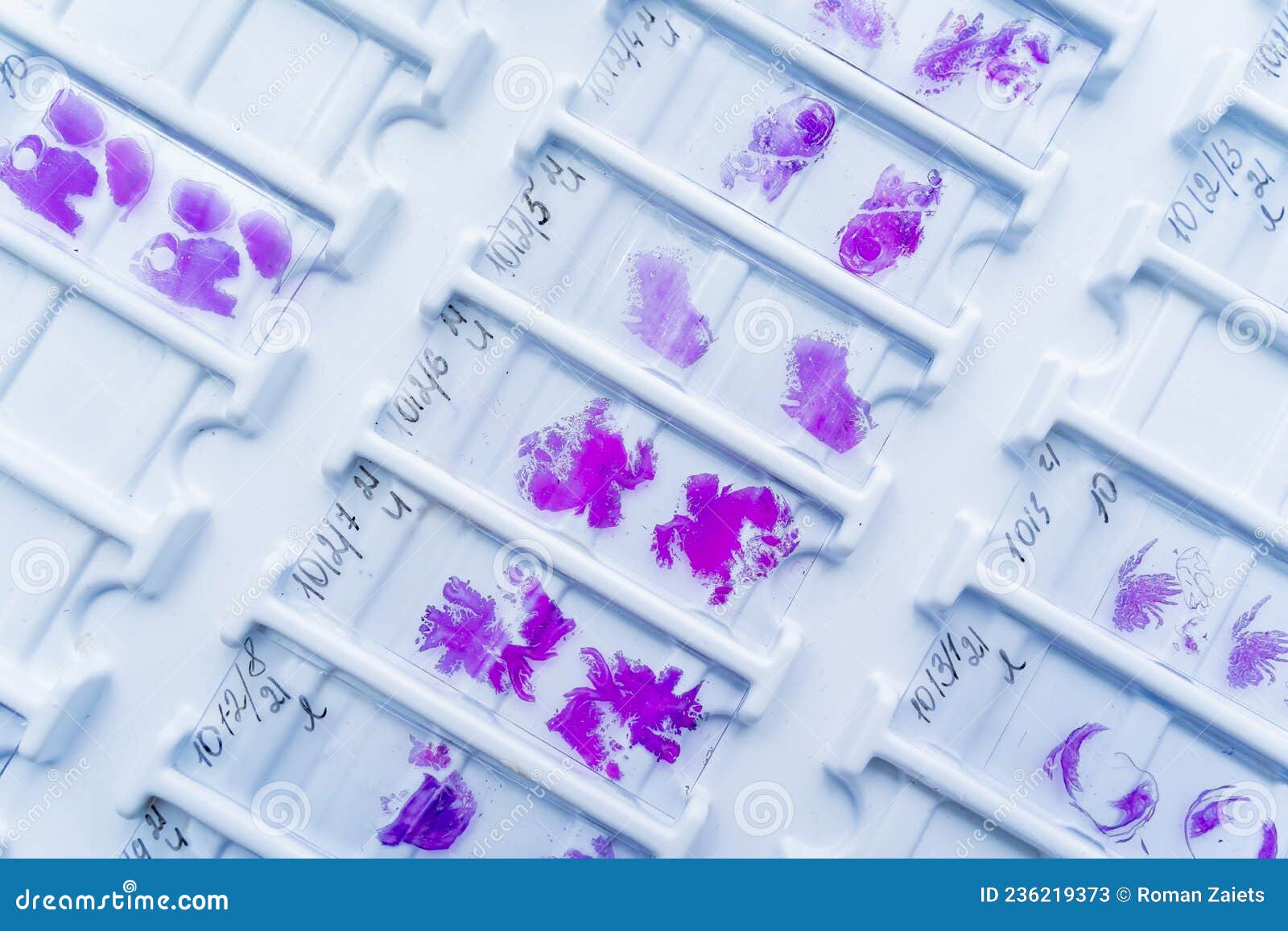 Rows of Microscope Glass Slide in the Cells Stock Image - Image of ...