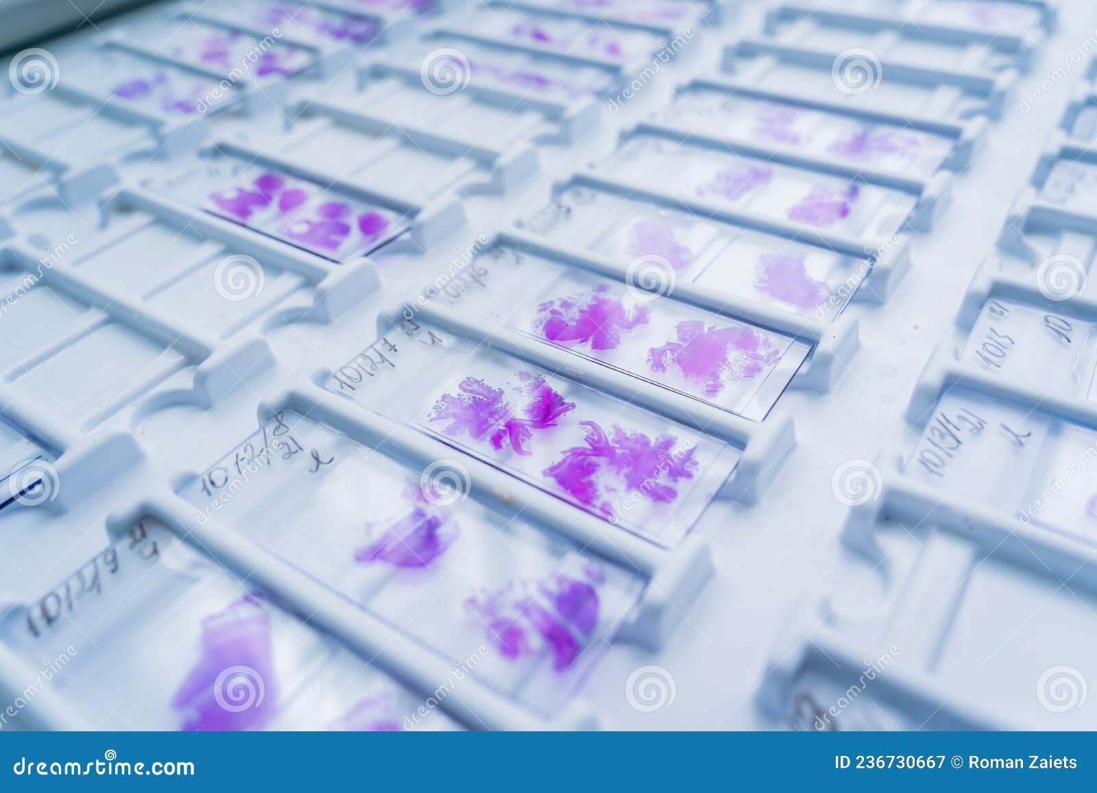 Rows of Microscope Glass Slide in the Cells Stock Image - Image of ...