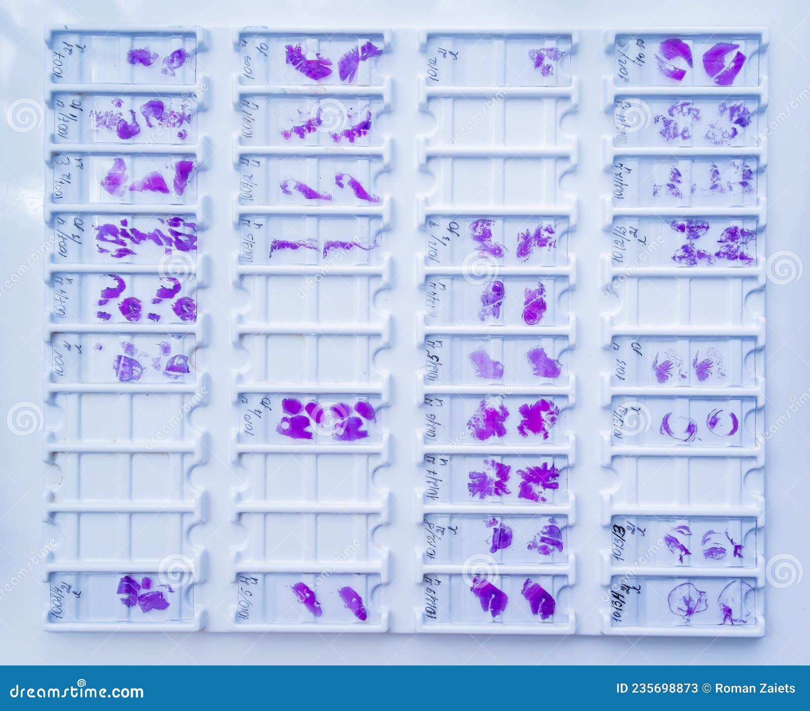 Rows of Microscope Glass Slide in the Cells Stock Image - Image of test ...