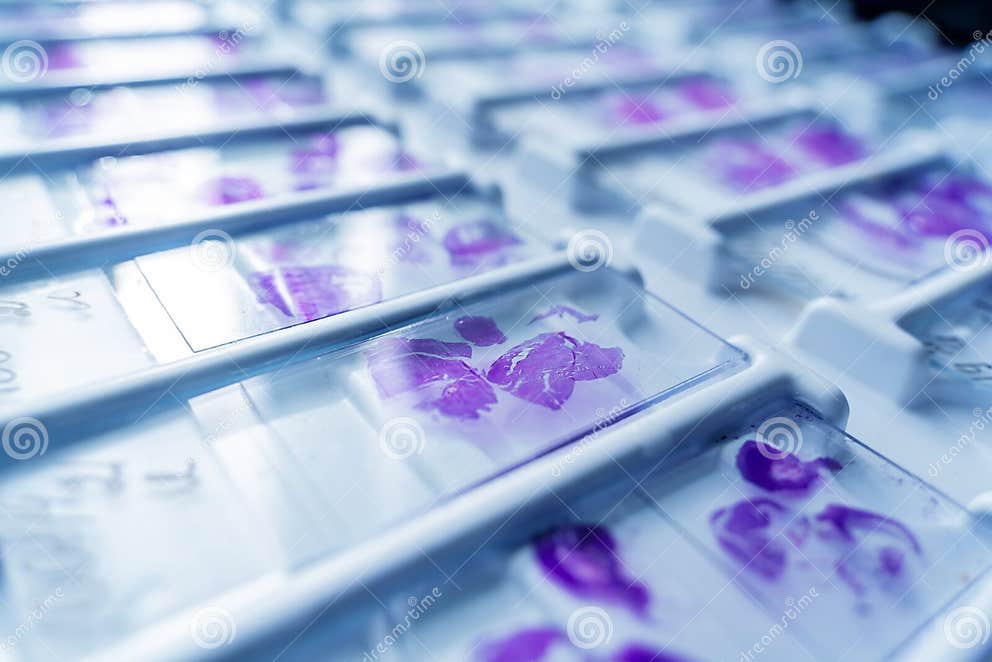Rows of Microscope Glass Slide in the Cells Stock Image - Image of ...