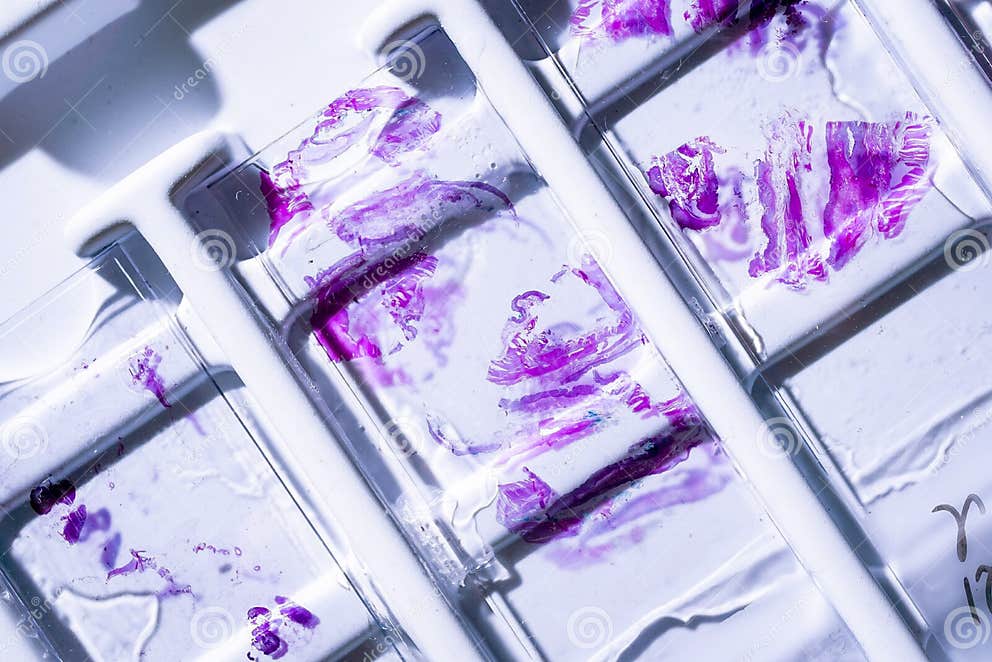 Rows of Microscope Glass Slide in the Cells Stock Image - Image of test ...