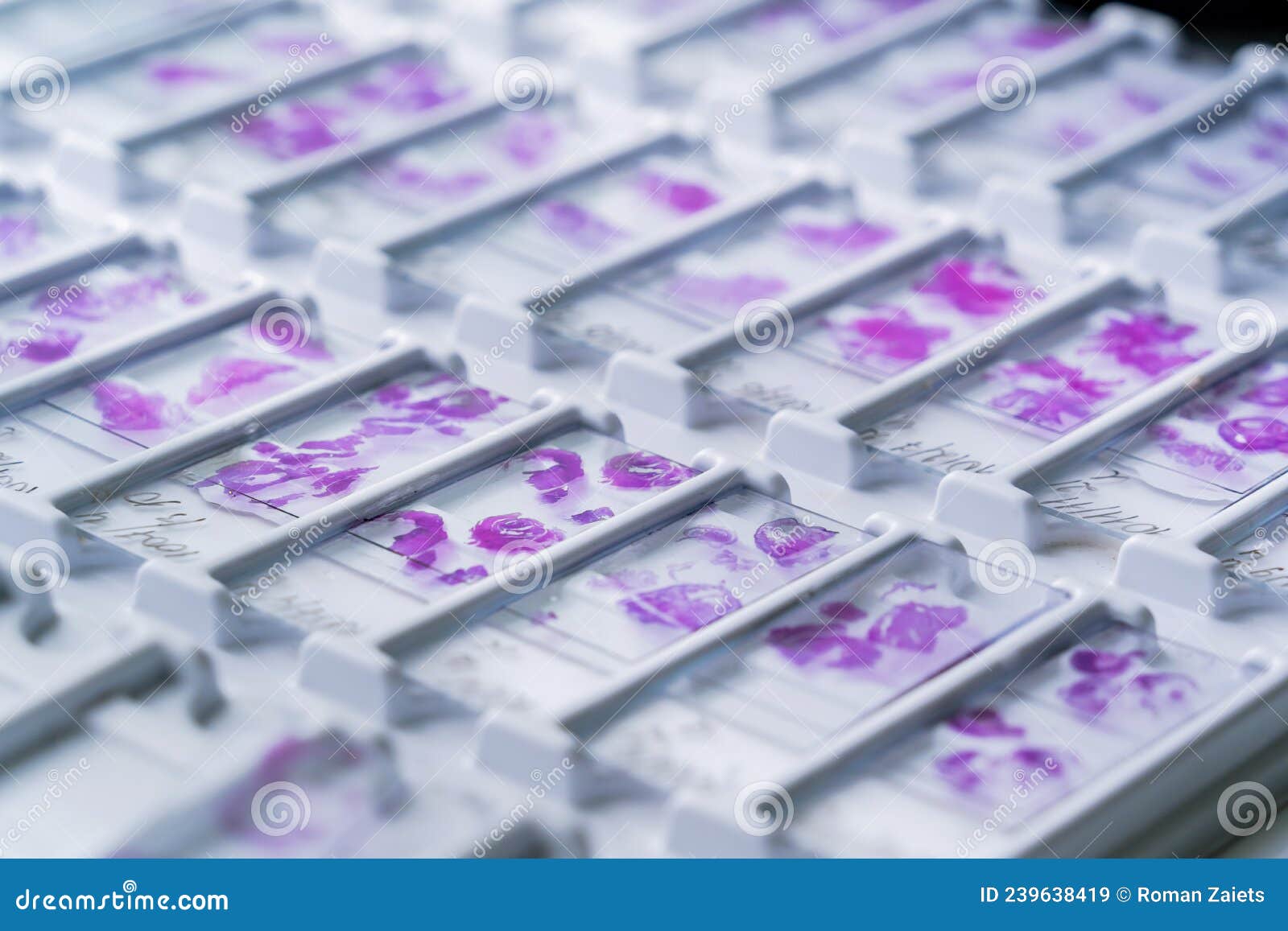 Rows of Microscope Glass Slide in the Cells Stock Image - Image of ...