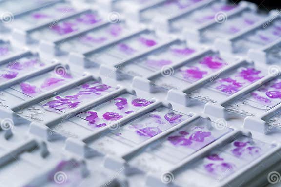 Rows of Microscope Glass Slide in the Cells Stock Image - Image of ...