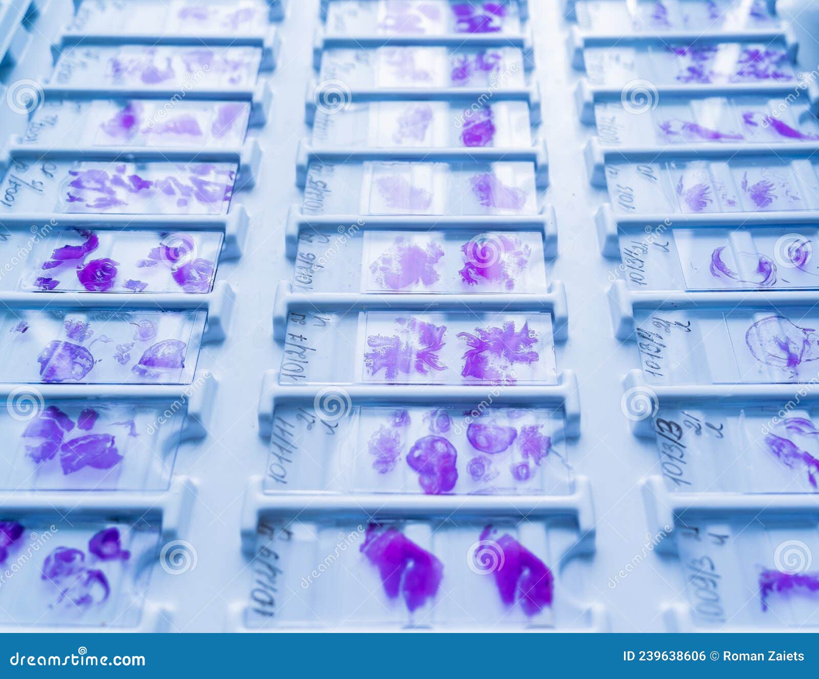 Rows of Microscope Glass Slide in the Cells Stock Photo - Image of ...