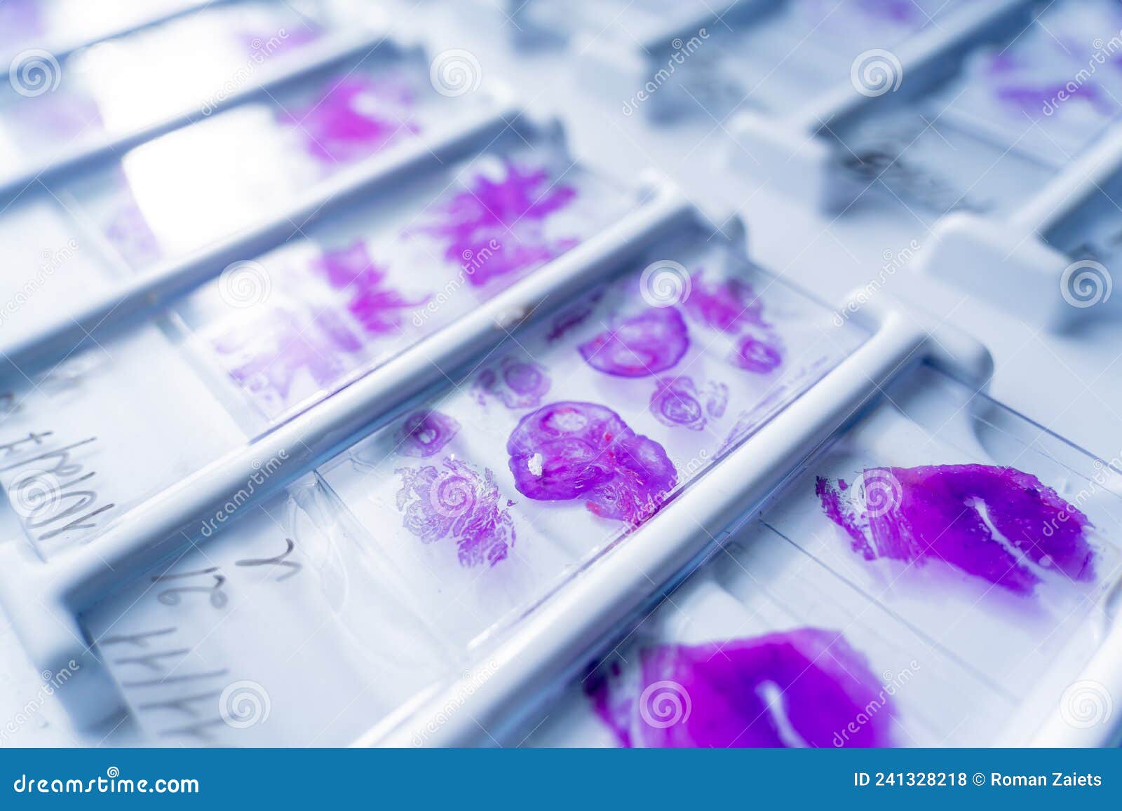 Rows of Microscope Glass Slide in the Cells Stock Photo - Image of ...