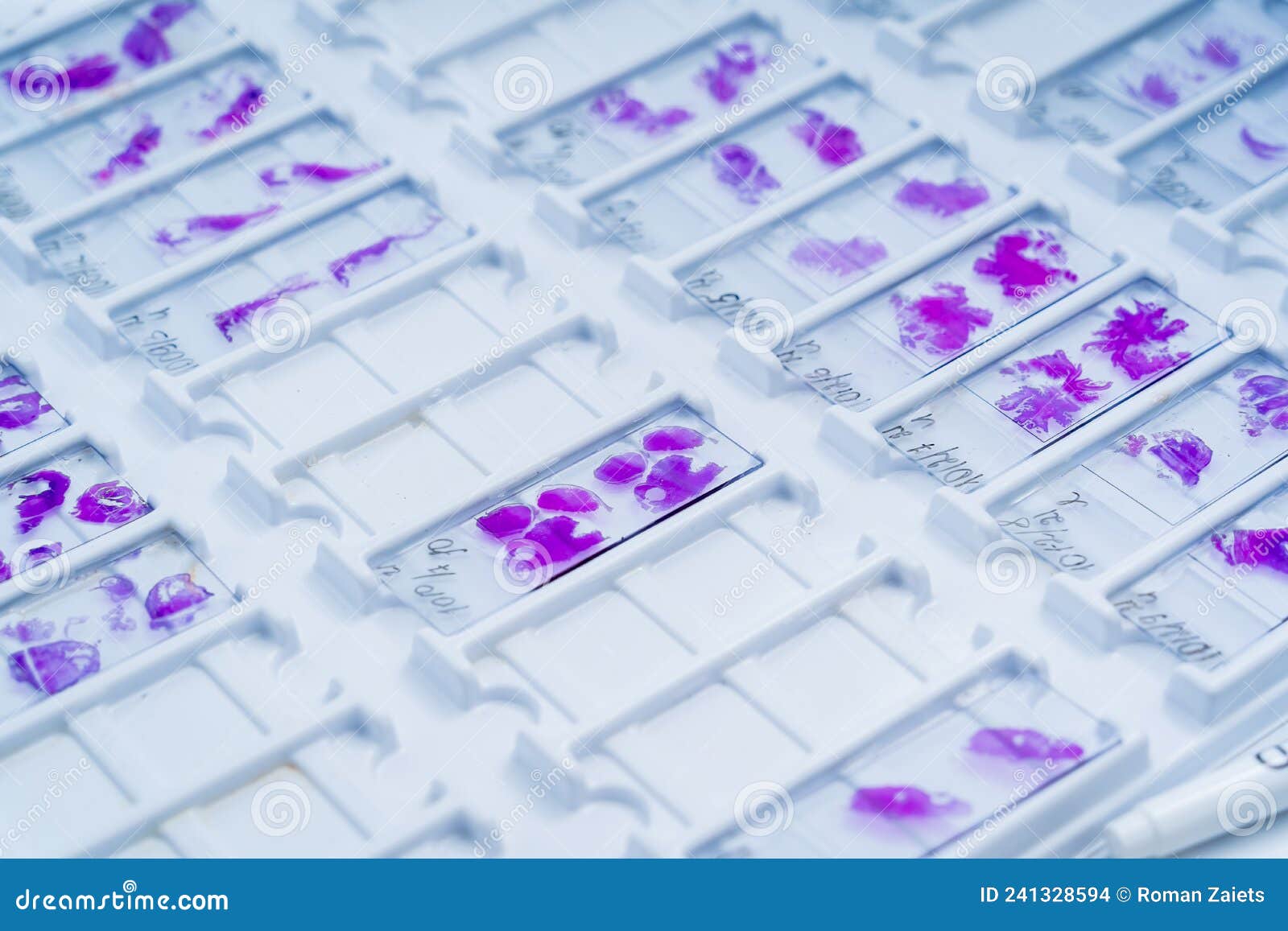 Rows of Microscope Glass Slide in the Cells Stock Photo - Image of ...