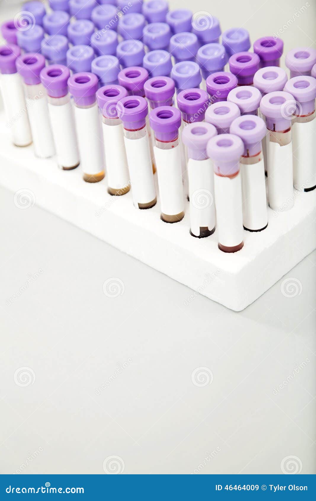 Rows of Test Tubes stock image. Image of professional - 46464009