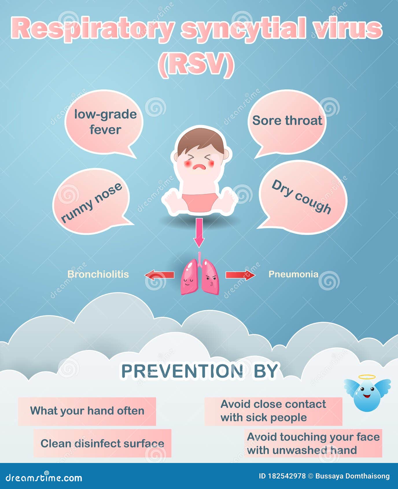 RSV,Respiratory Syncytial Virus Infographic,illustration. Cartoon ...