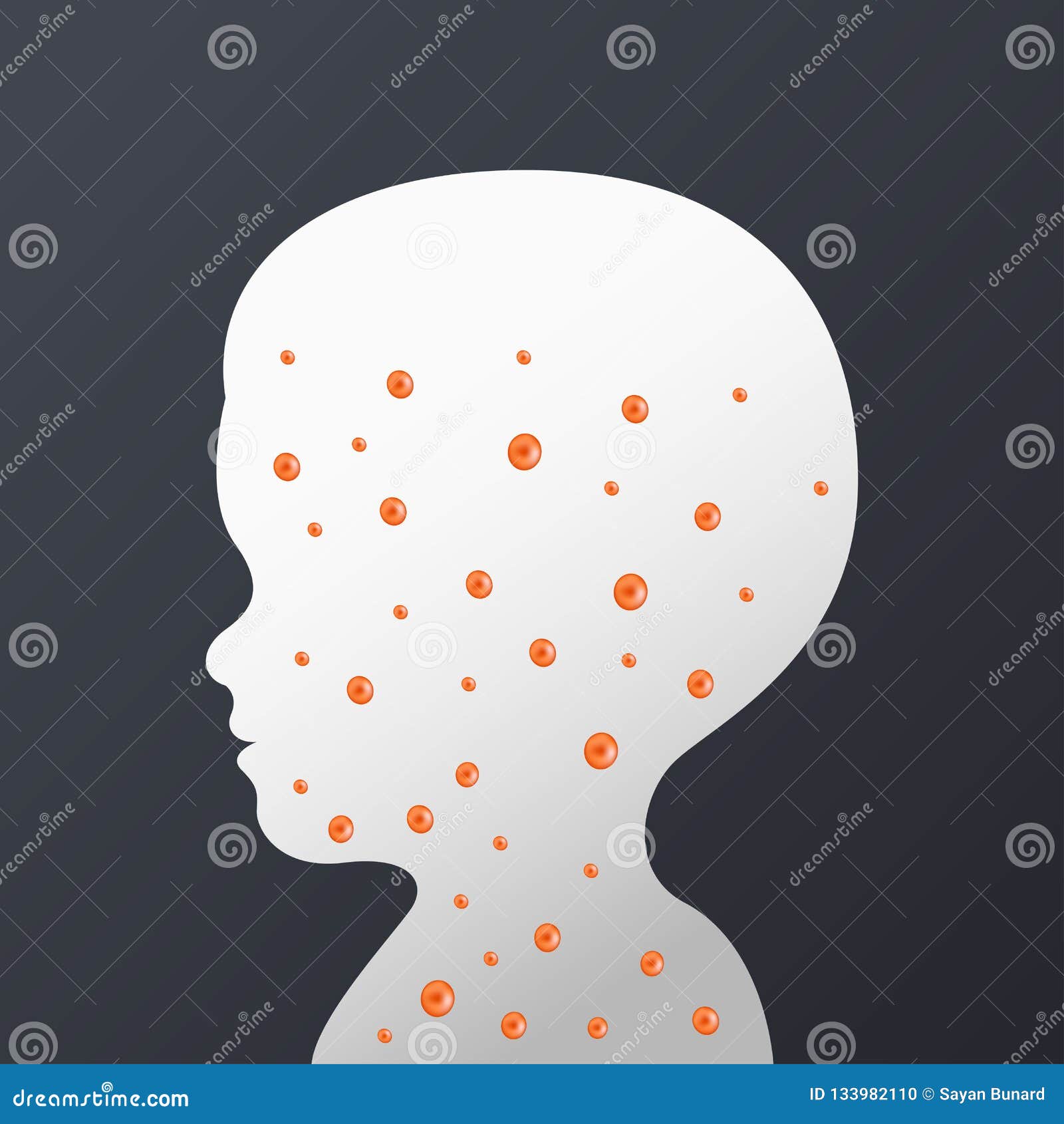 Rubella German Measles Logo Icon Design Cartoon Vector | CartoonDealer ...
