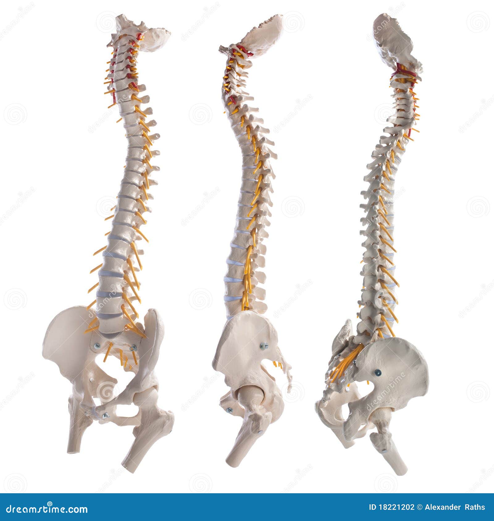 Ruggegraat stock foto. Image of apparatuur, ziekte, kolom - 18221202