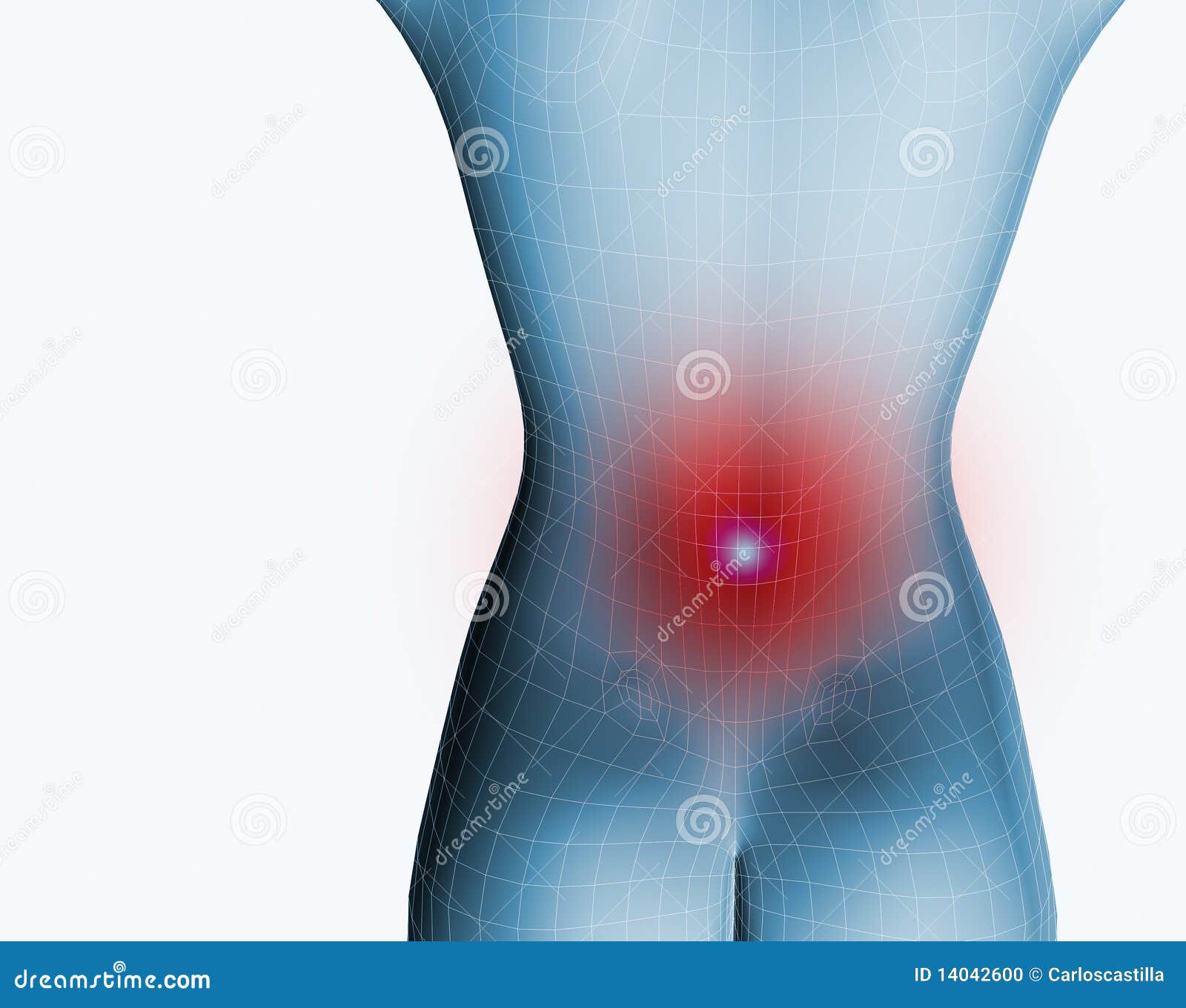 Rugpijn Stock Illustrations, Vectors, & Clipart – (8,791 Stock ...