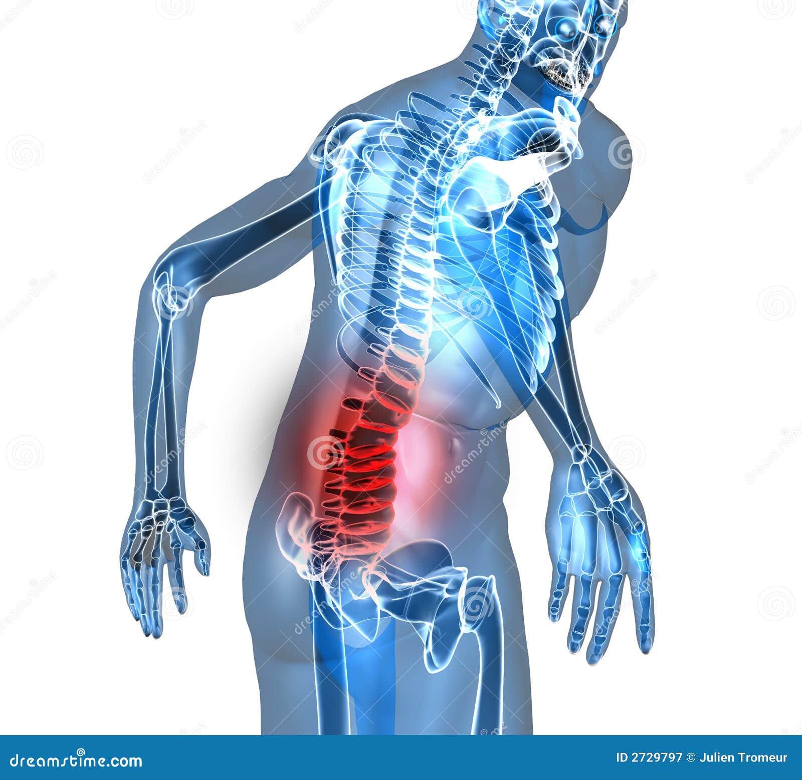 Rugpijn stock illustratie. Illustration of anatomie, ruggegraats - 2729797