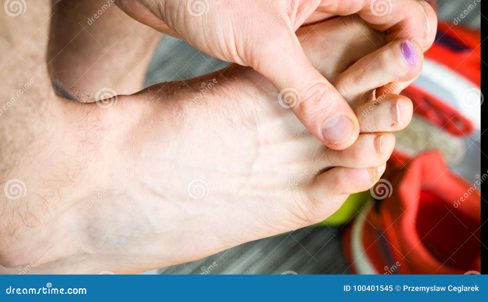 Runner`s nail stock image. Image of nail, jogger, blood - 100401545