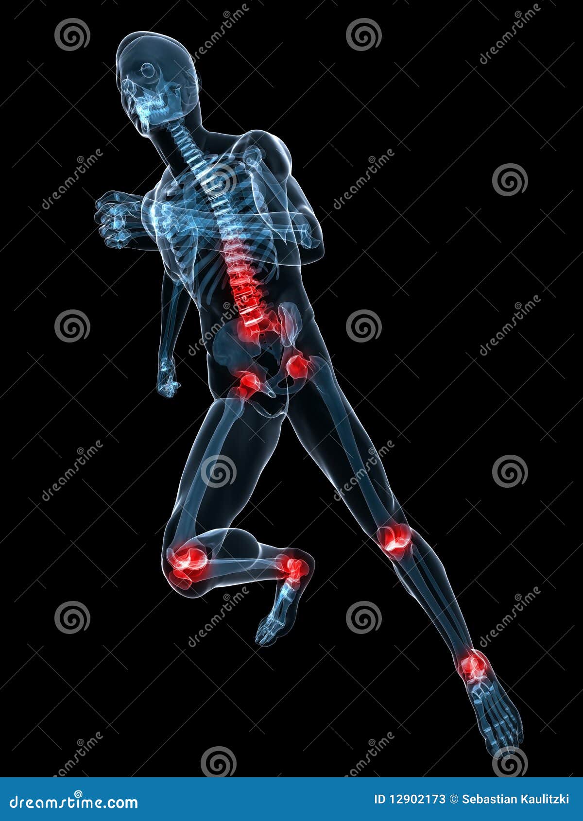 Running Skeleton - Painful Joints Stock Illustration - Illustration of ...