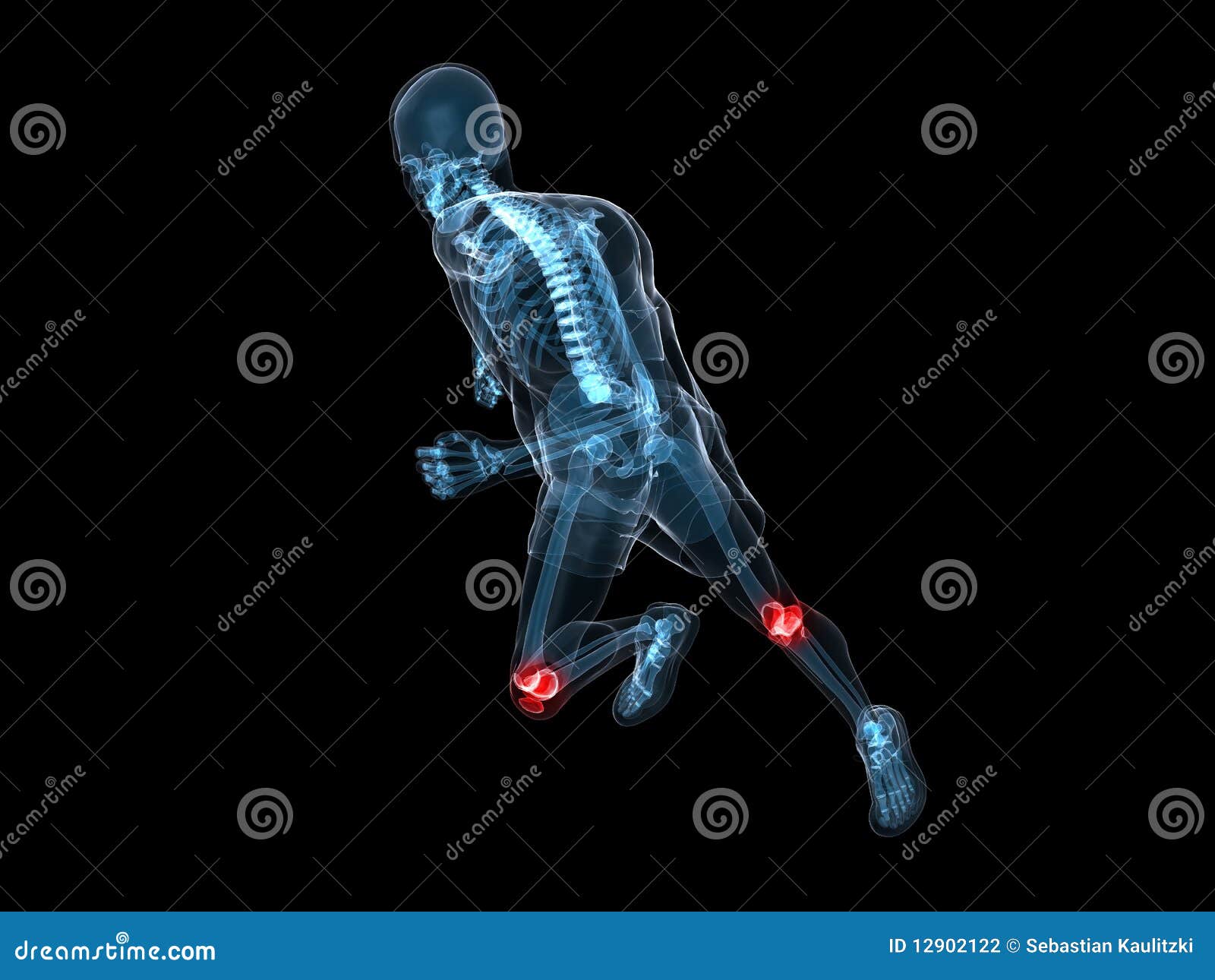Running Skeleton - Painful Knees Stock Illustration - Illustration of ...