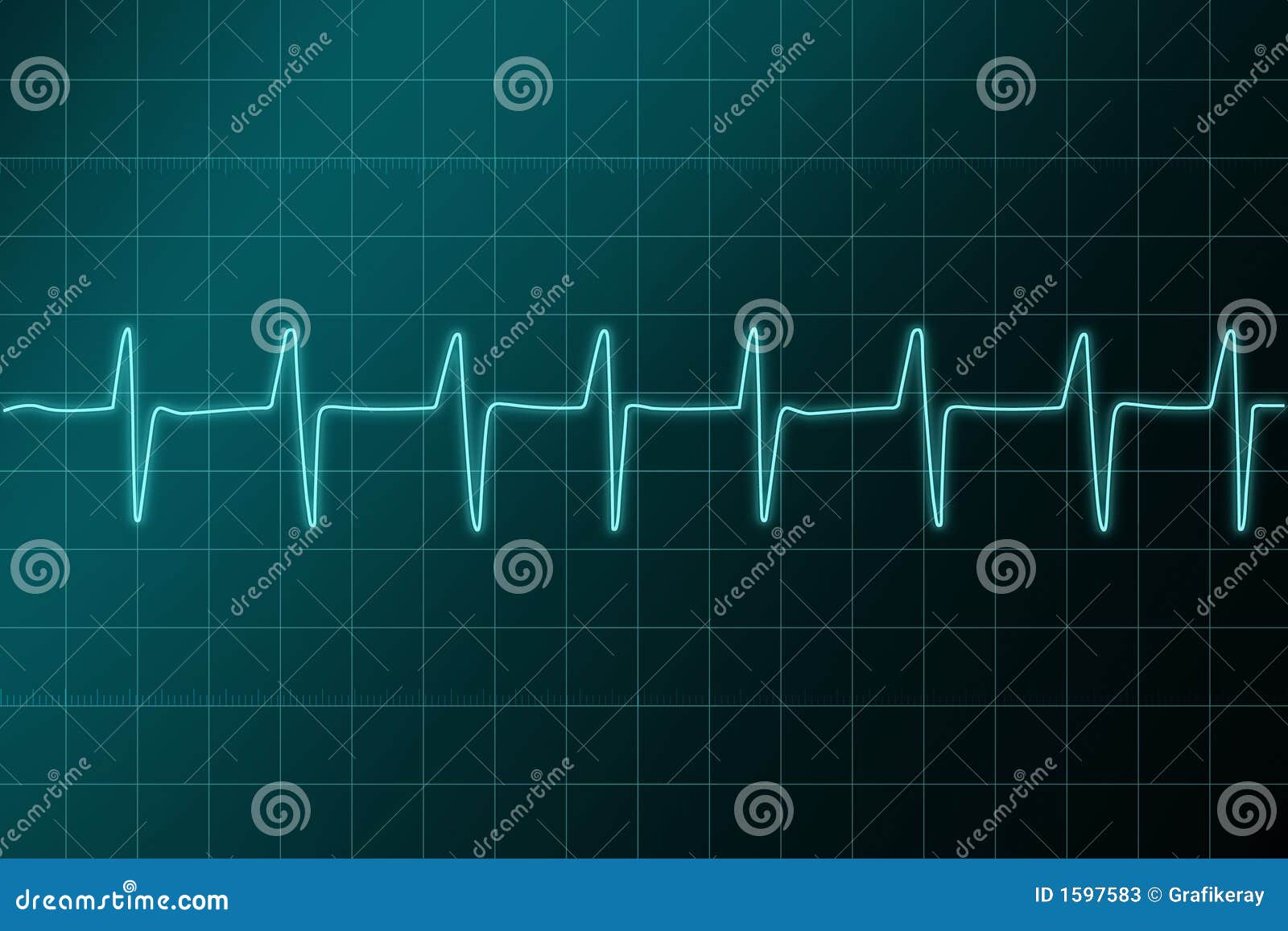Rythme Cardiaque Du Cardiogramme 2 Illustration Stock - Illustration du ...