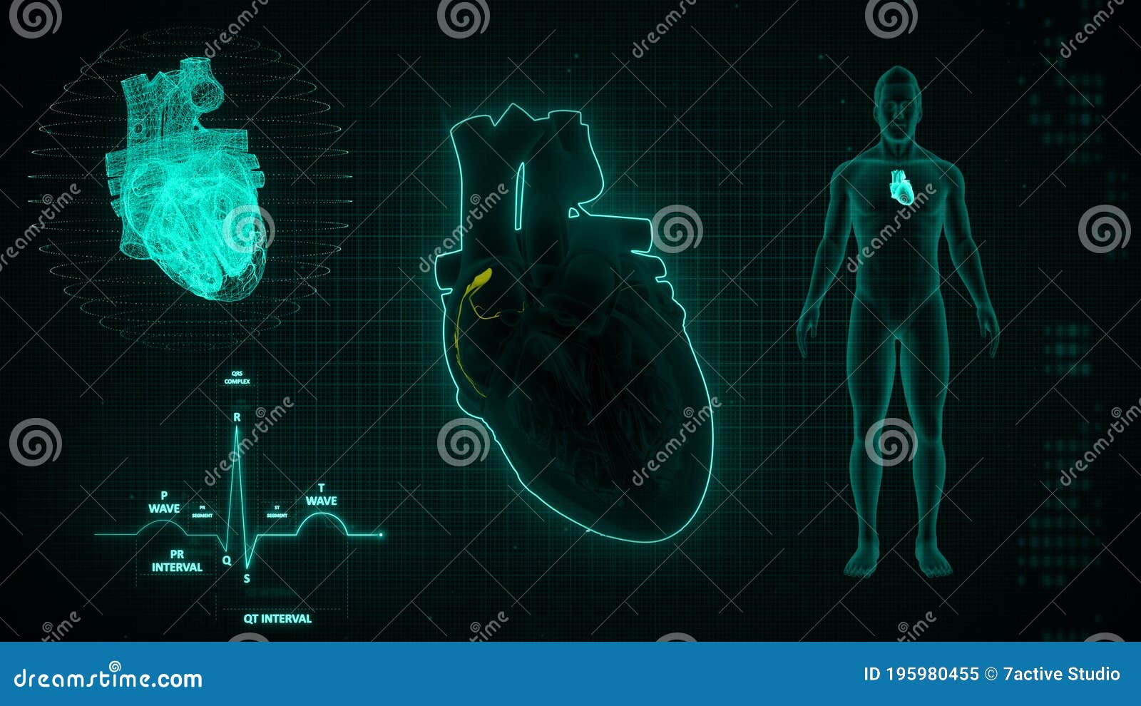 SA Nodes Signal in the Heart or Sinoartial Node Signal Stock ...