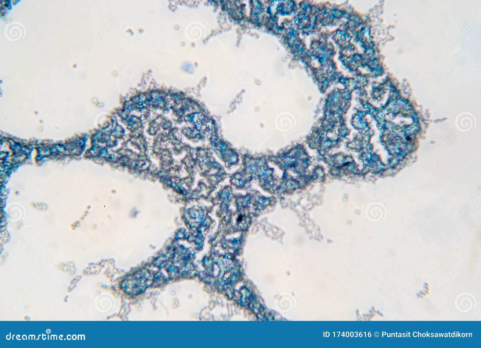Saccharomyces Cerevisiae Microscope