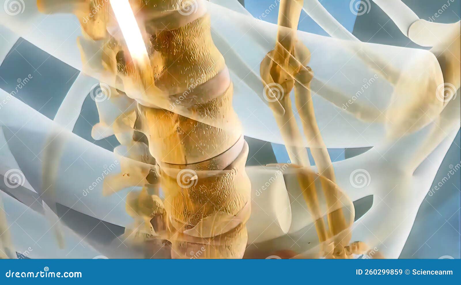 Sacral Nerve Stimulation, Also Known As Sacral Neuromodulation Stock ...