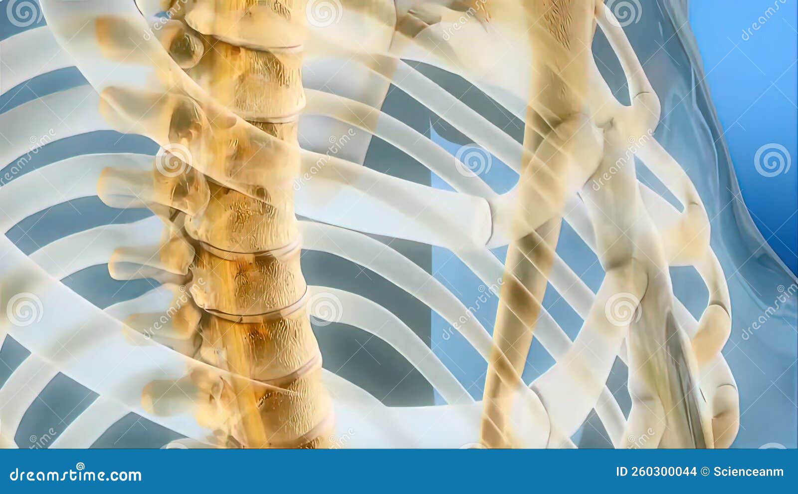 Sacral Nerve Stimulation, Also Known As Sacral Neuromodulation Stock ...