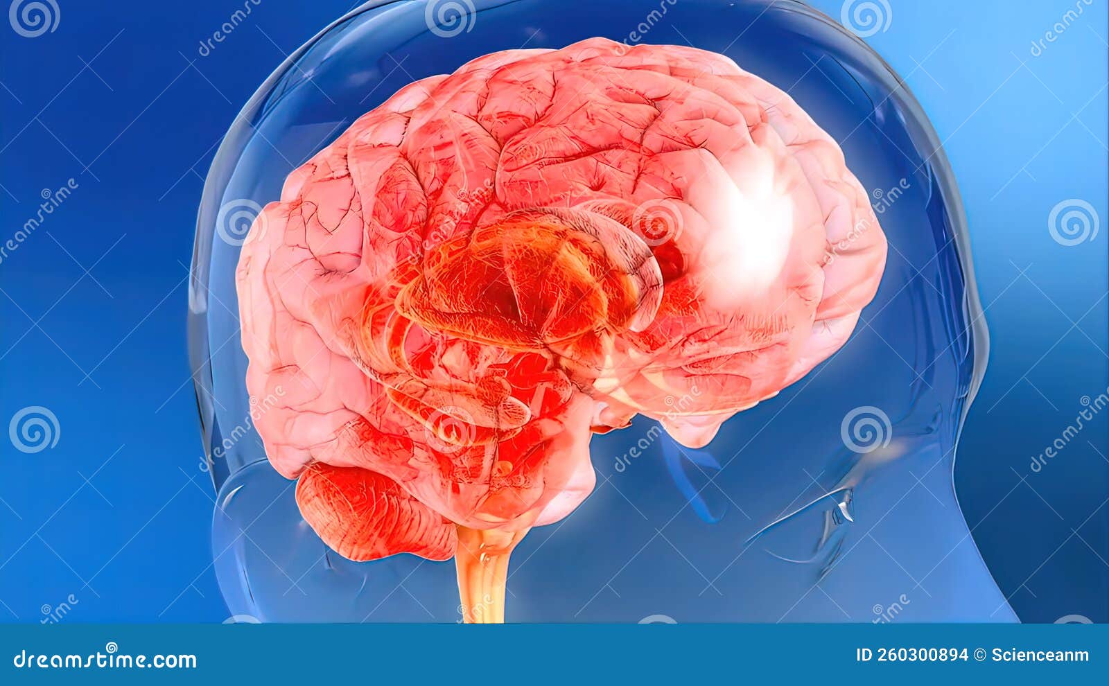 Sacral Nerve Stimulation, Also Known As Sacral Neuromodulation Stock ...