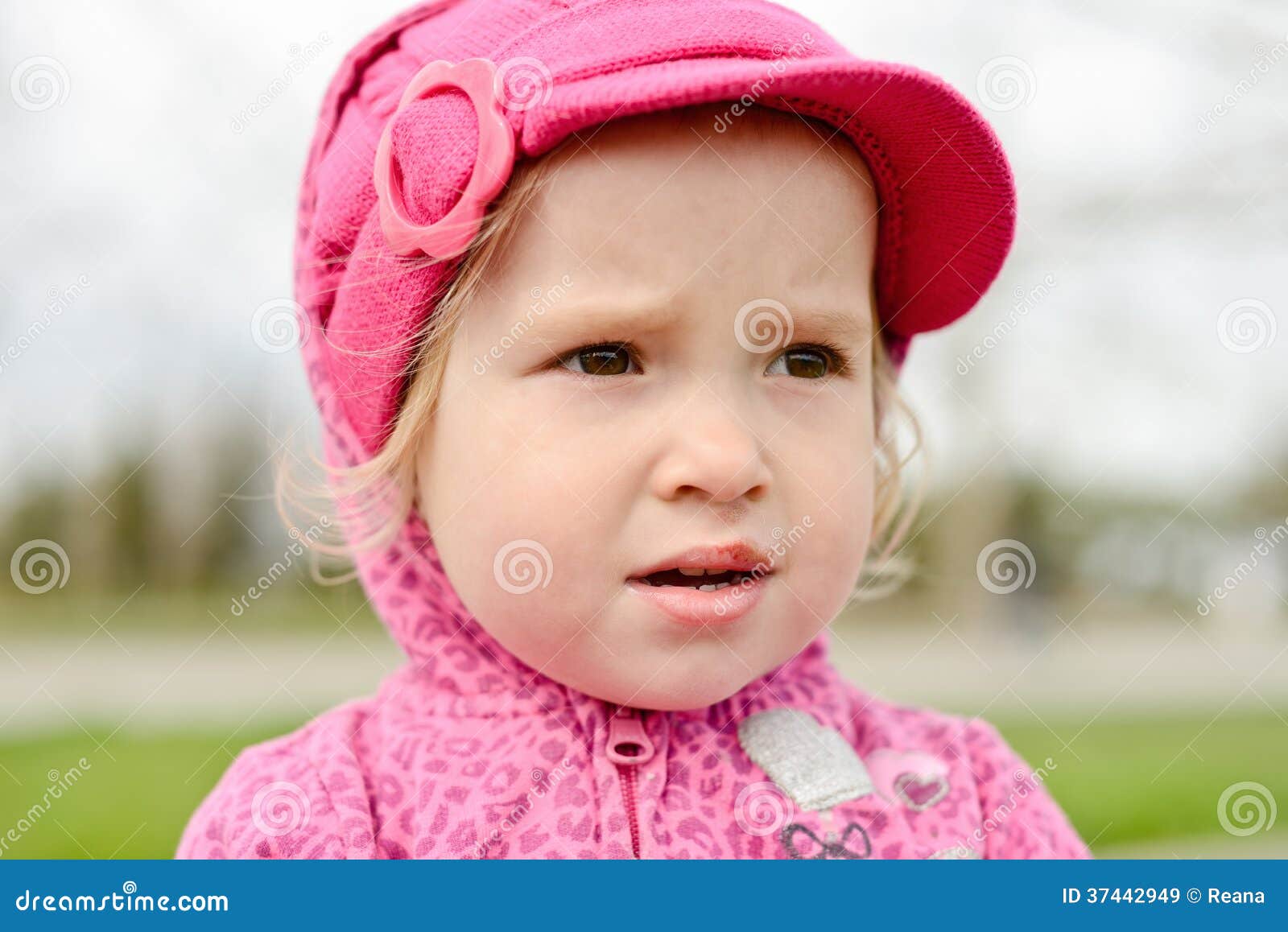 Sad Girl with Injury on Lip Stock Image - Image of assistance, person ...